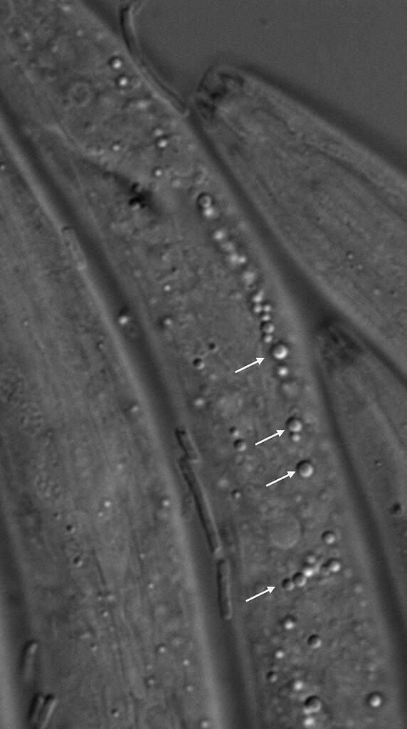 Epidermal 'vesicle' identification - WormAtlas - Alliance of Genome ...